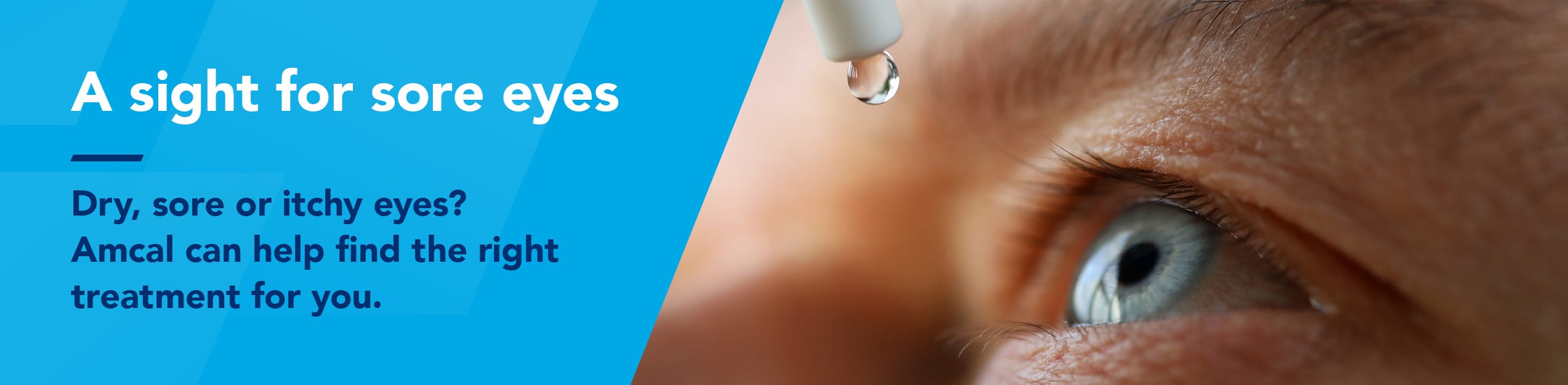 Managing dry eyes - Amcal Pharmacy